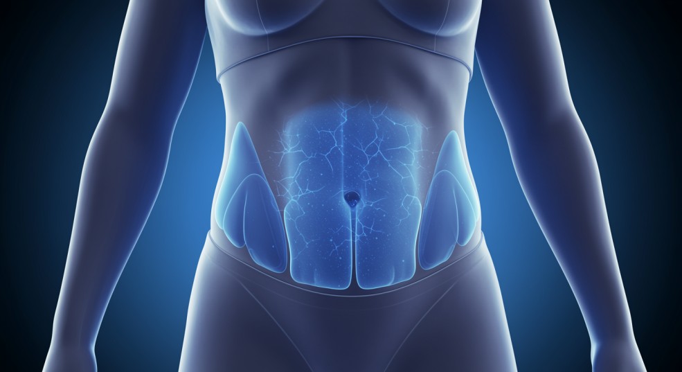 Sculpt body with Fat Freezing Technology : Cryotherapy